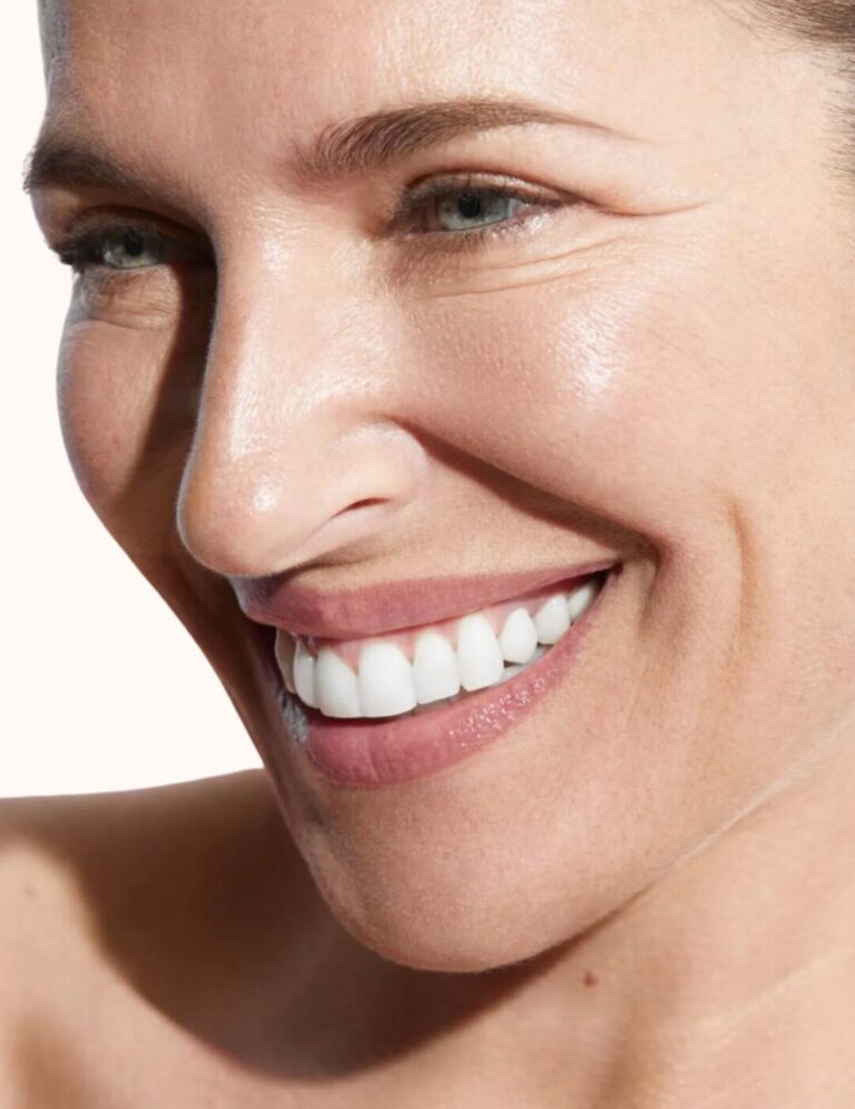 Digital Composite Bonding — Smiles and Smiles